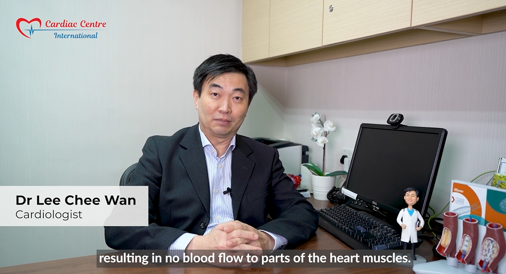 Heart Screening | Cardiologist Singapore | Orchard